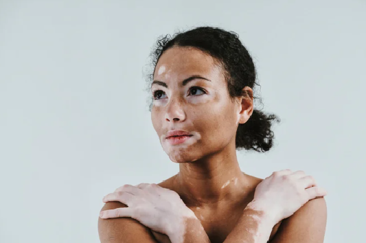 Embracing the Most Embarrassing Parts of Your Body – Skills To Change ...